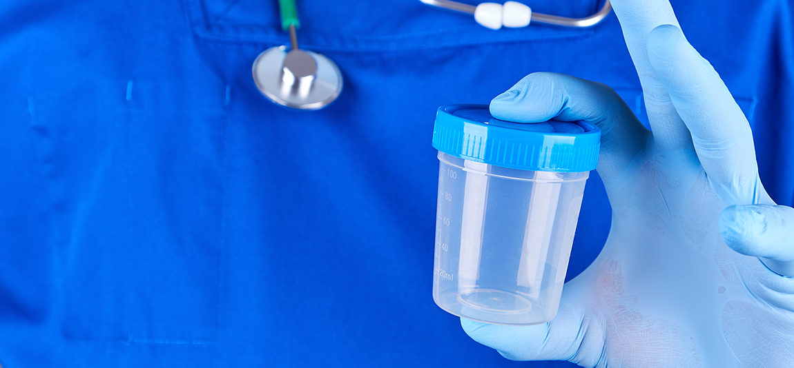 Urine test for bladder cancer could replace thousands of invasive ...